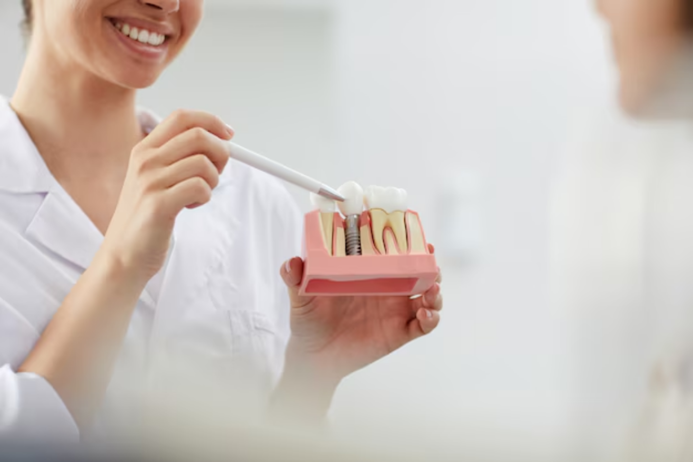 How to Floss Dental Implants: Tips for Optimal Oral Health and Care